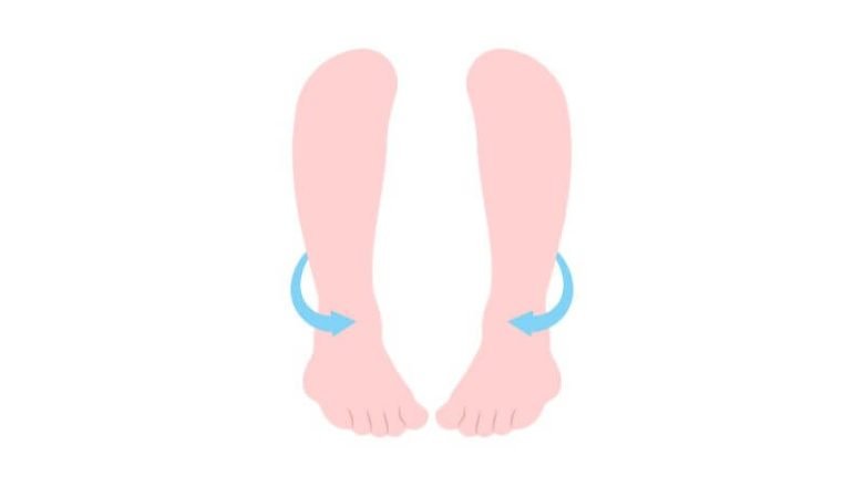 How To Fix Bowed Legs In Adults? (Accurate Answer)